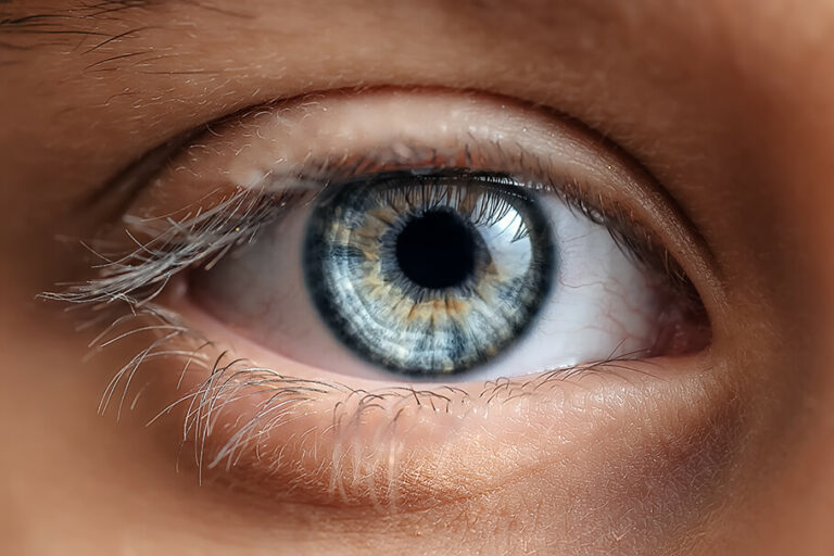 Iritis Boynton Beach | Eye Doctor Boynton Beach | Joshi Eye Institute